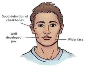 Mewing Appliance - A Device to Improve Your Facial Appearance
