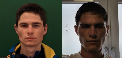 Bone smashing - Mewing Appliance