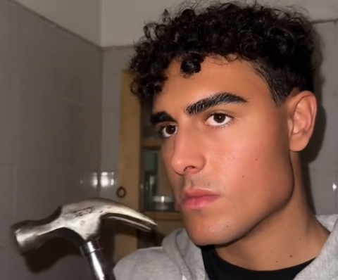 Bone smashing - Mewing Appliance